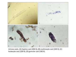 Urine analysis | PPTX