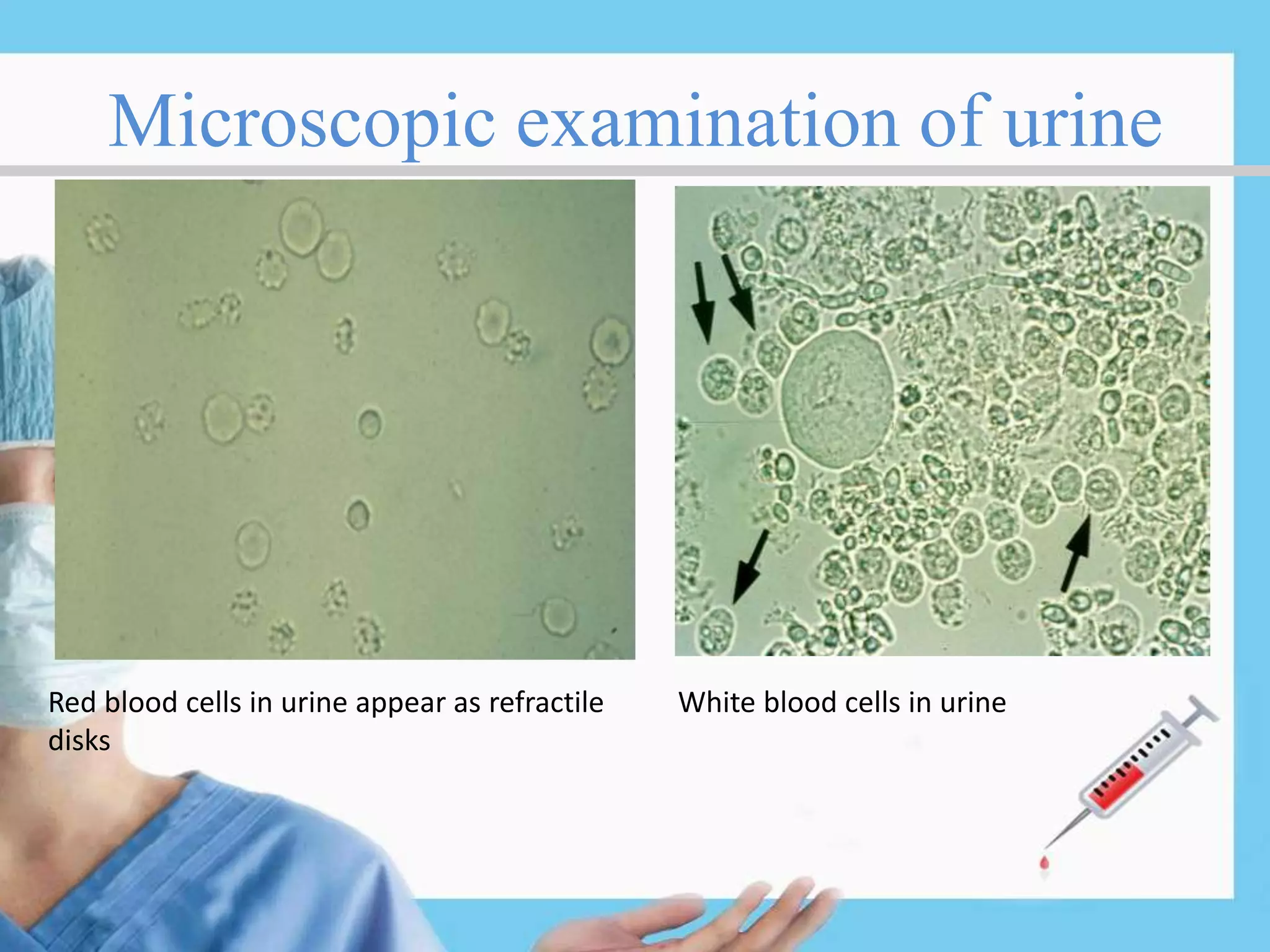 Urine analysis | PPTX