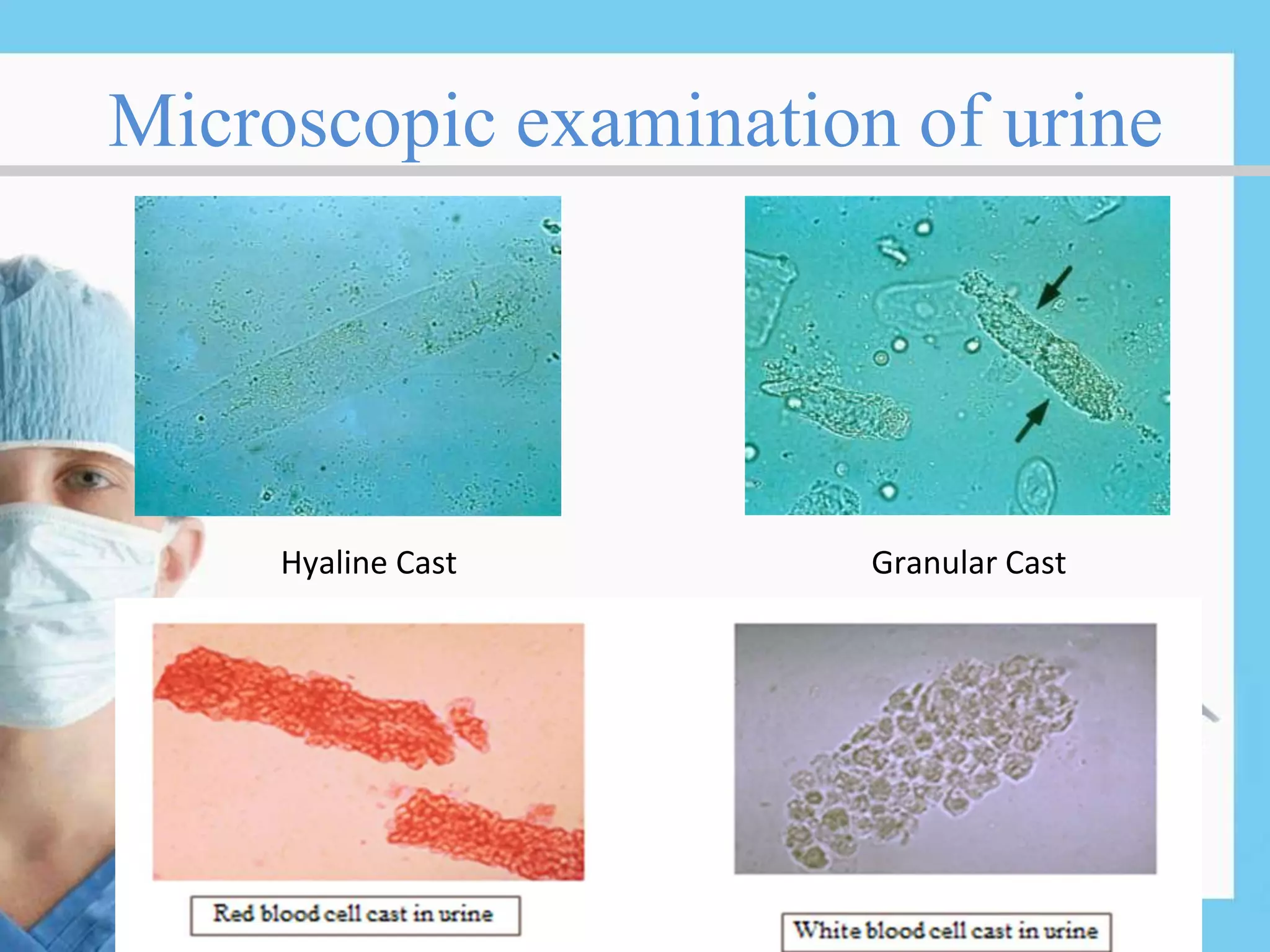 Urine analysis | PPTX