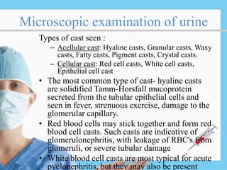 Urine analysis | PPTX