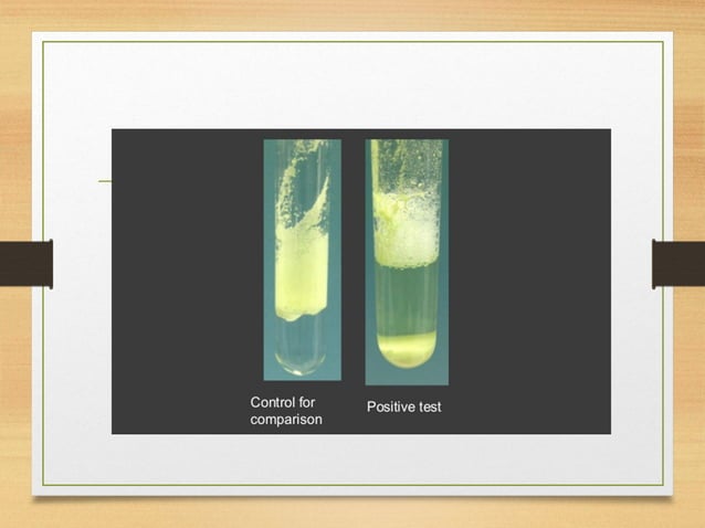 Urine analysis | PPT | Chemistry | Science