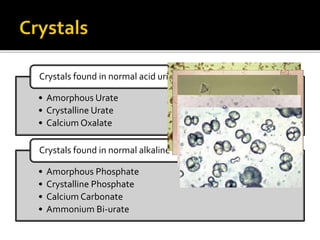 Urine analysis Part1 | PPTX