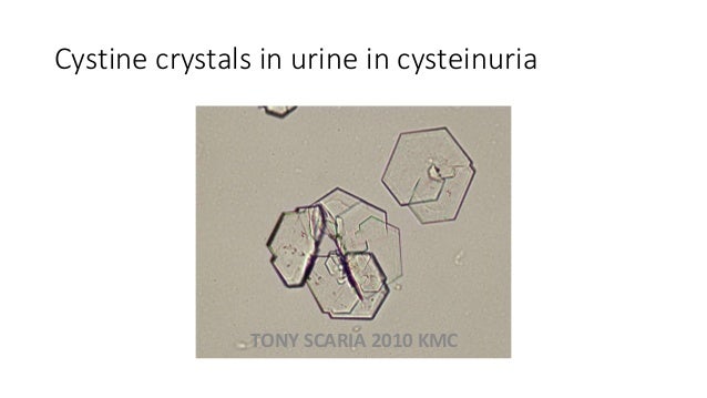 Urine analysis REVISION NOTES