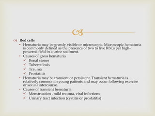 Urine analysis | PPTX | Blood Disorders | Diseases and Conditions