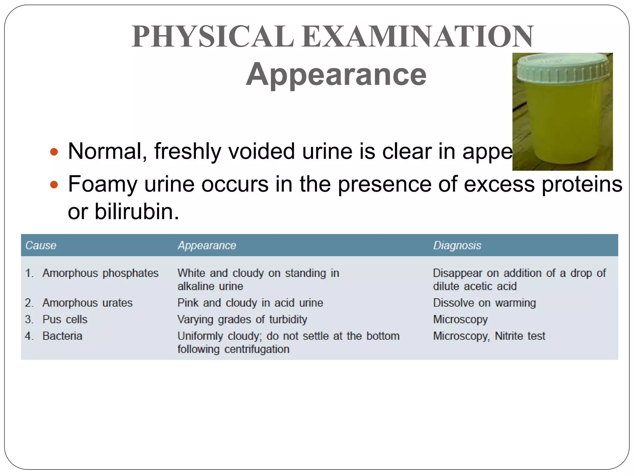 Urine analysis | PPTX