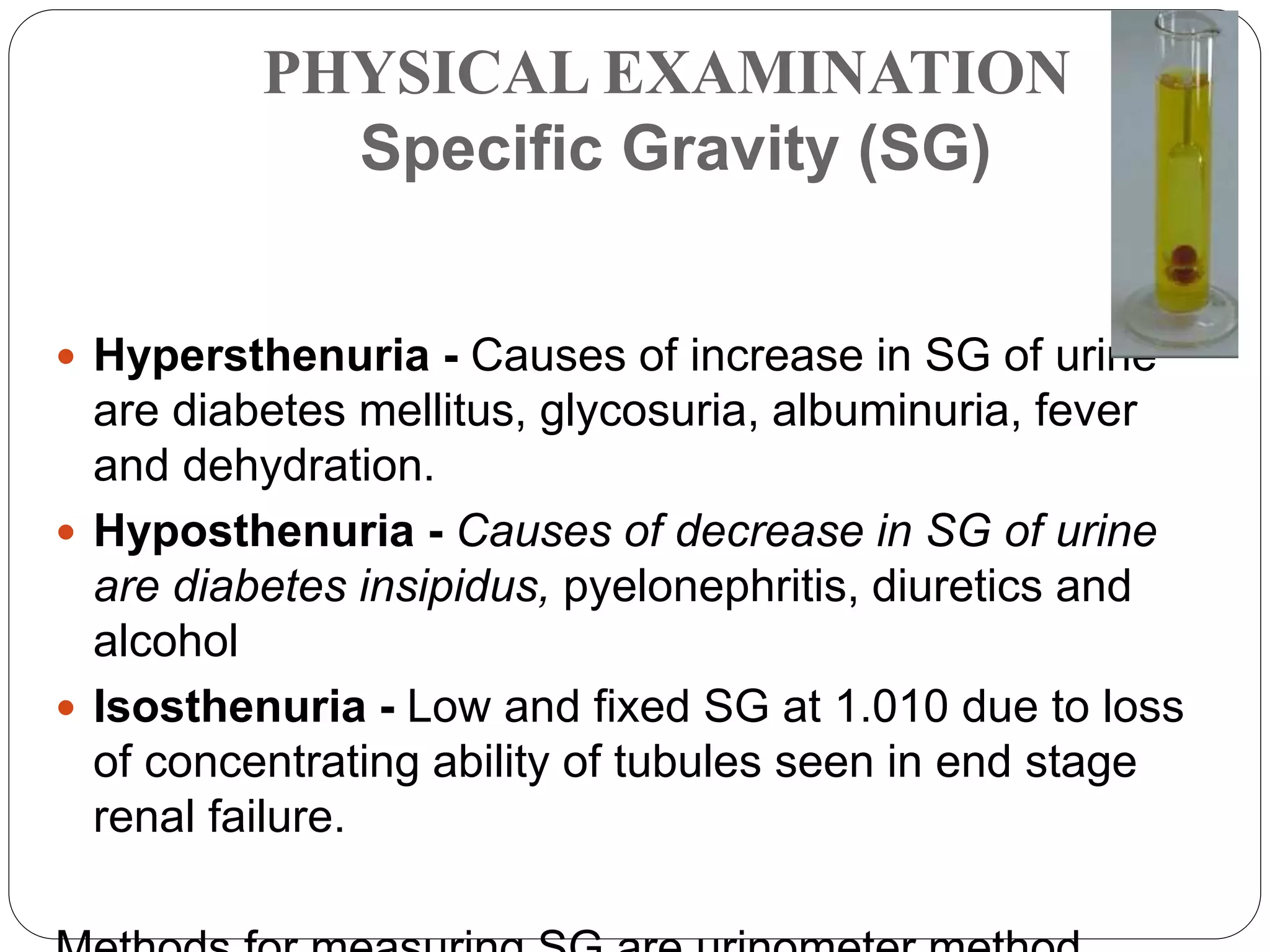 Urine analysis | PPTX