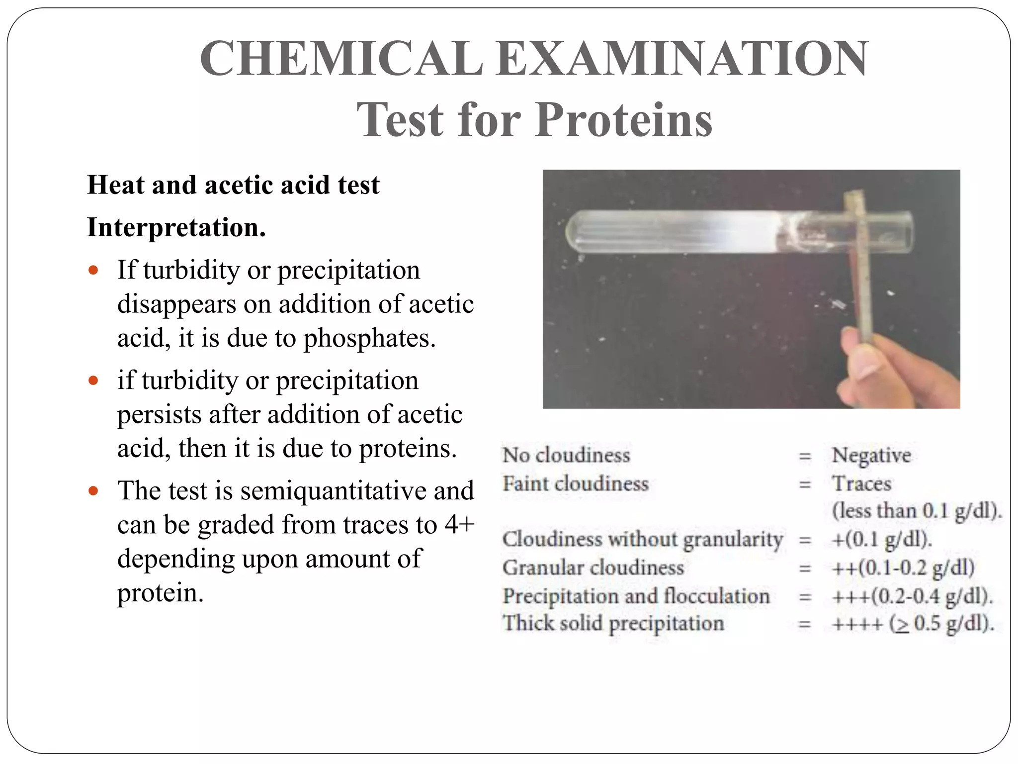 Urine analysis | PPTX