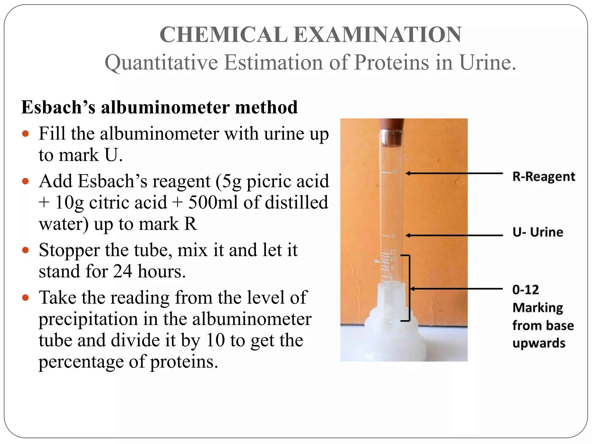 Urine analysis | PPTX