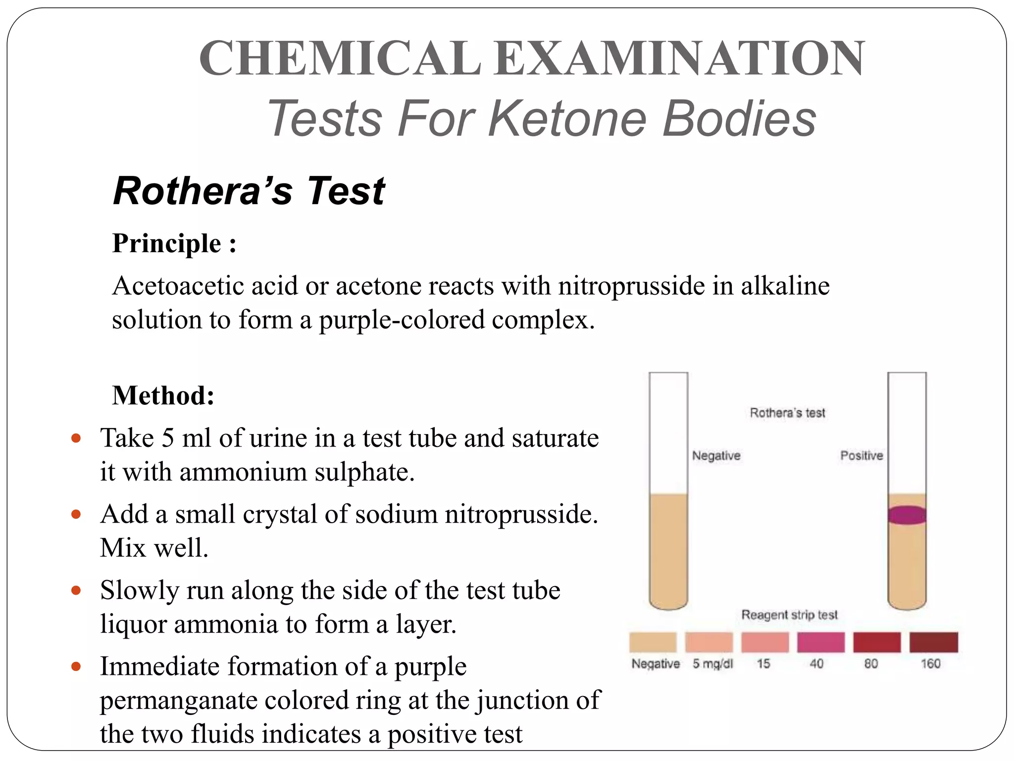 Urine analysis | PPTX