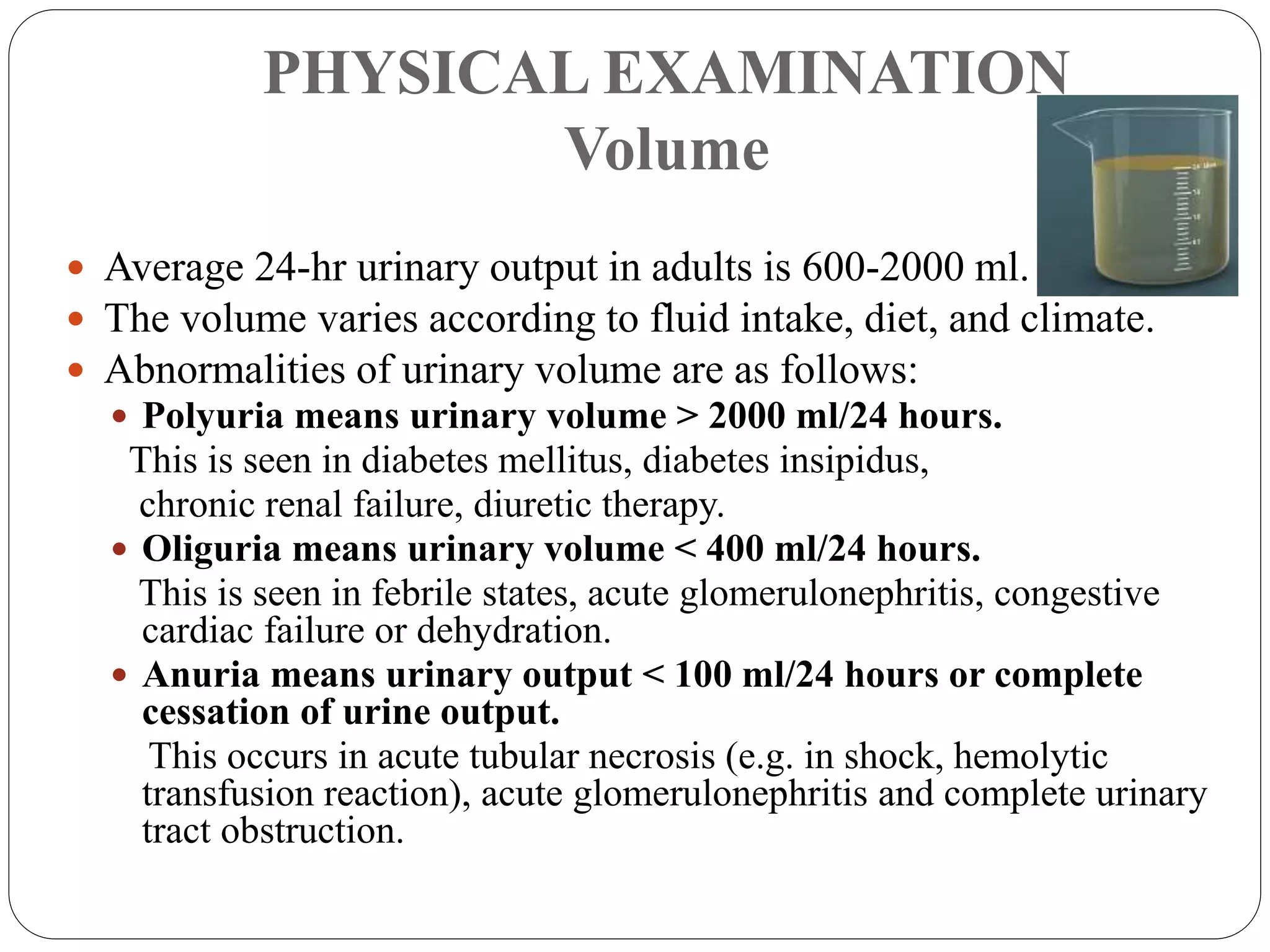 Urine analysis | PPTX