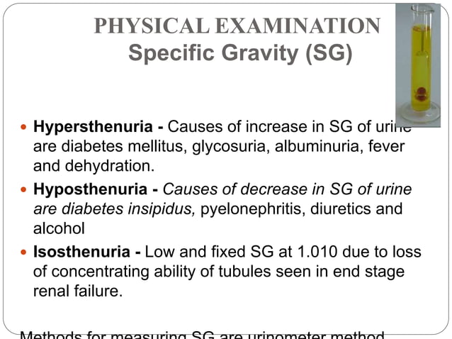 Urine analysis | PPTX | Blood Disorders | Diseases and Conditions