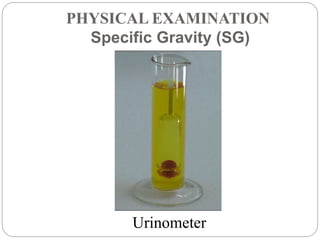 Urine analysis | PPTX