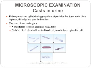 Urine analysis | PPTX
