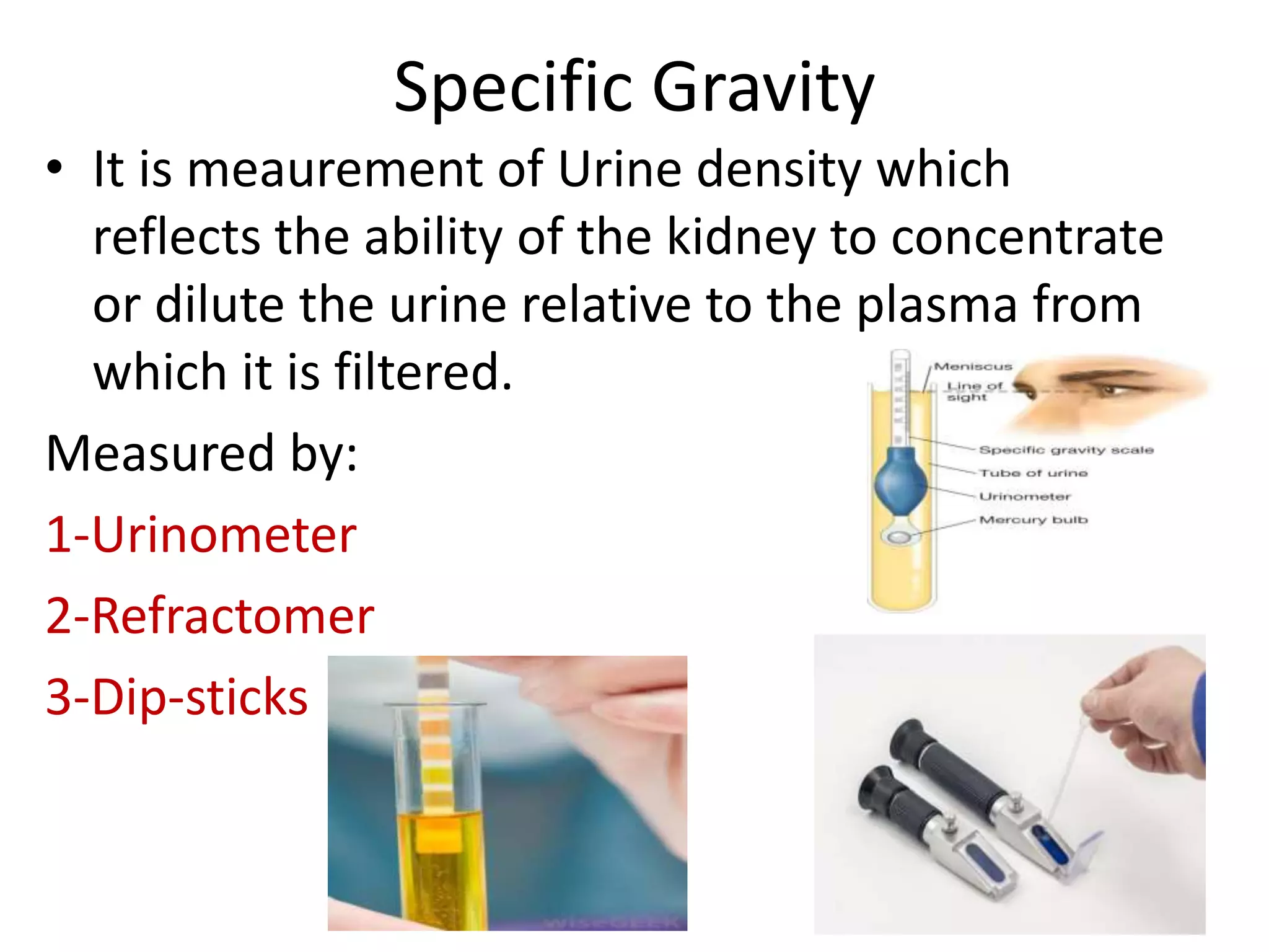 Urine analysis | PPTX