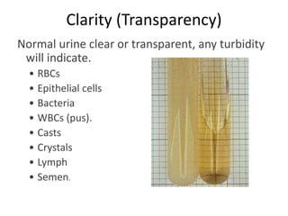 Urine analysis | PPTX
