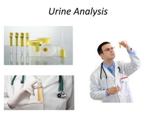 Urine analysis | PPTX