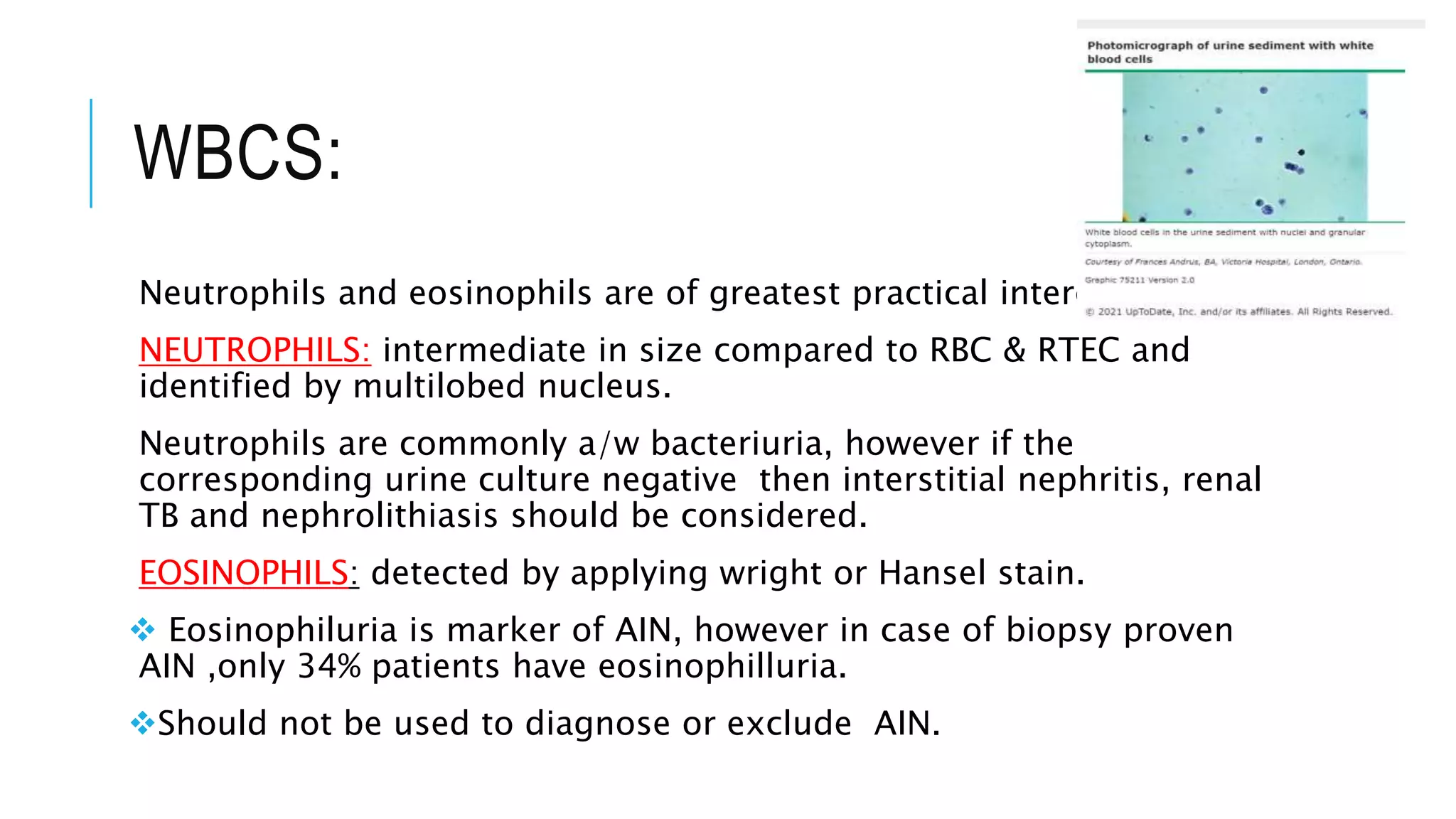 Urine analysis | PPTX