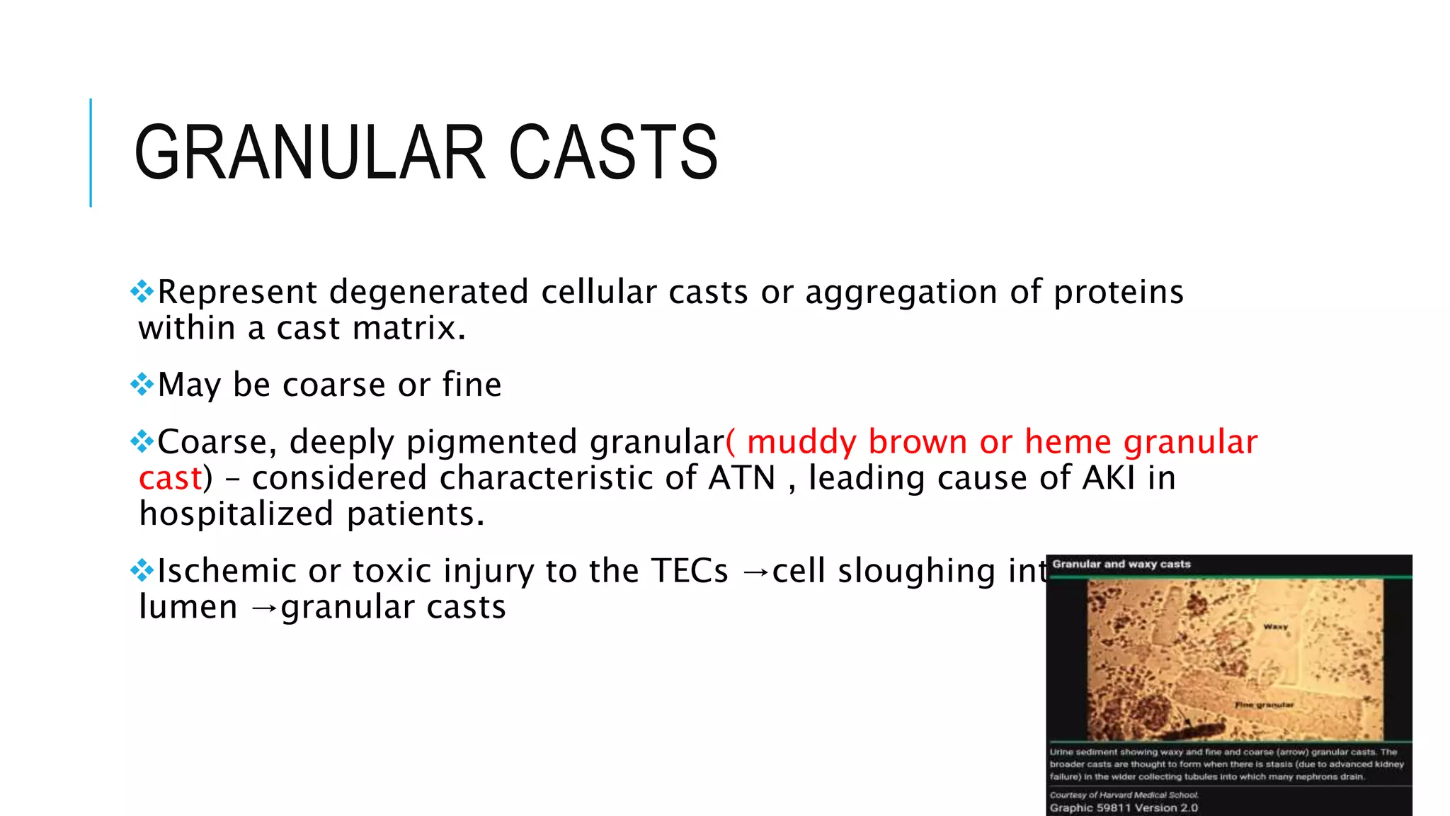 Urine analysis | PPTX