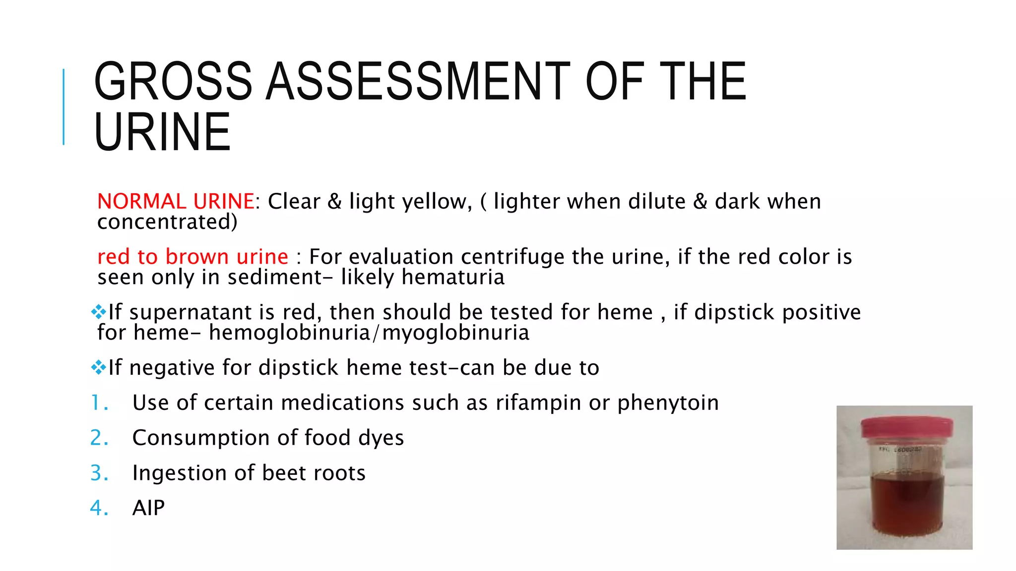 Urine analysis | PPTX