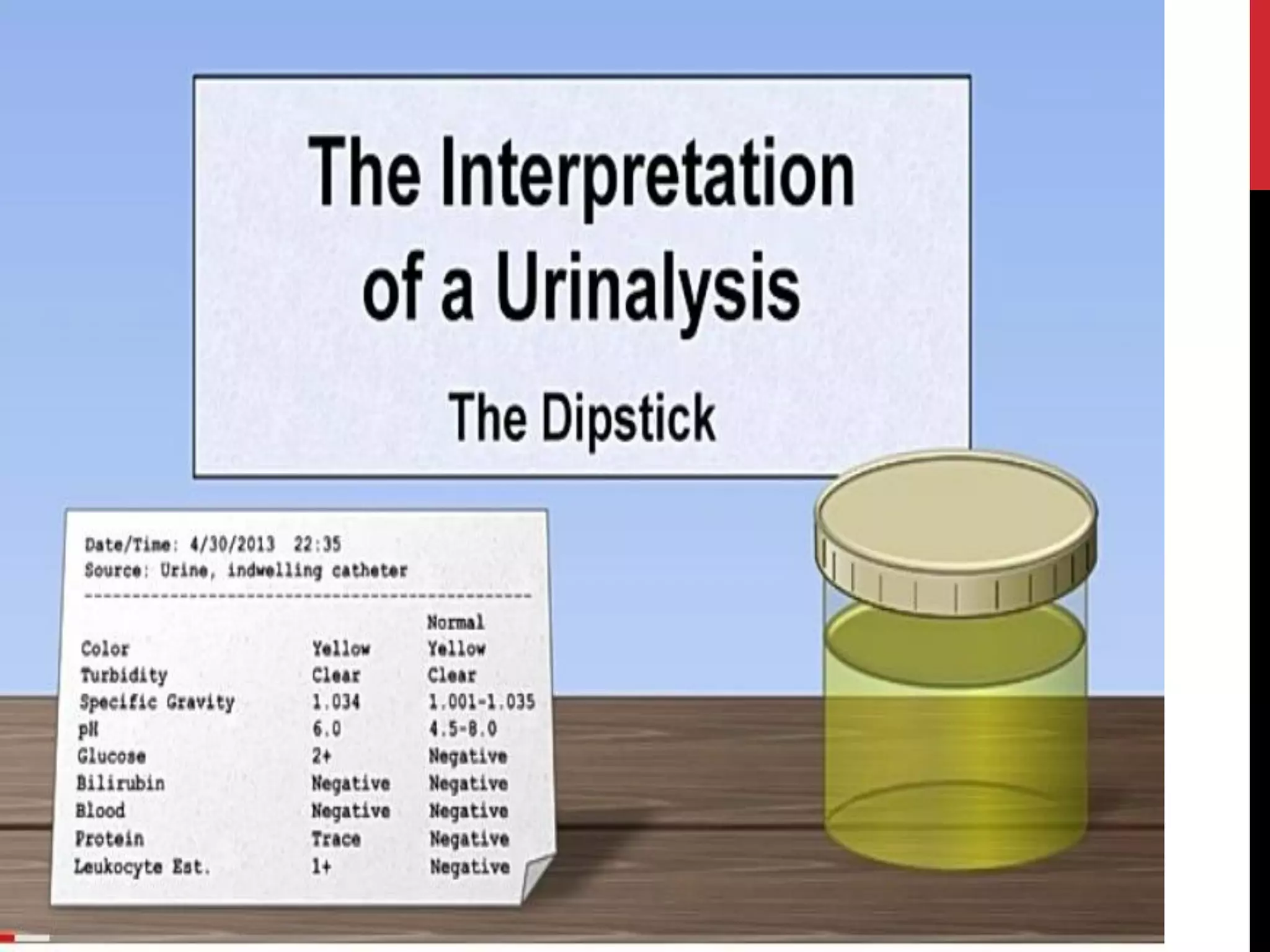 Urine analysis.pdf