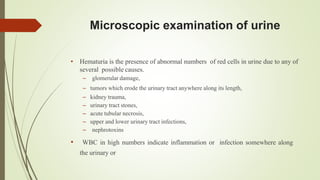 urine analysis.pptx