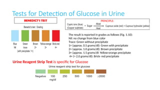 URINE Analysis with normal structure of nephron and physical ...