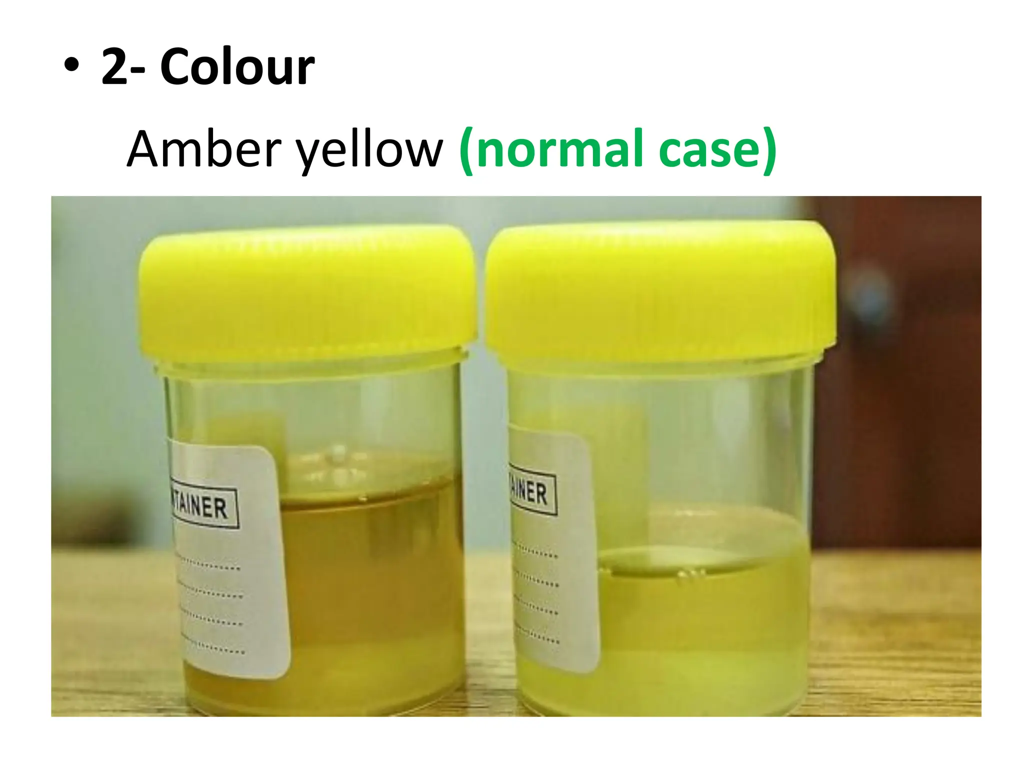 Urine Analysis.pdf....................... | PDF