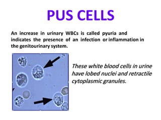 Urine Analysis.pdf....................... | PDF