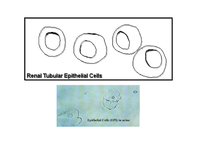 urinary analysis and test. $$&ppt bbbbbn | PPT
