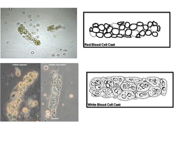urinary analysis and test. $$&ppt bbbbbn | PPT