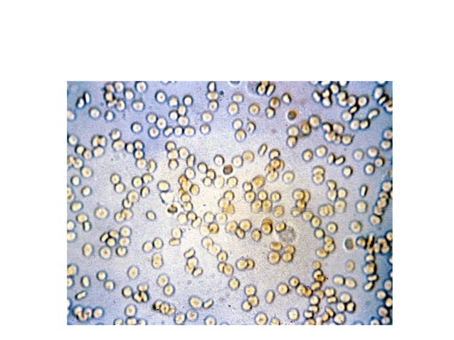 urinary analysis and test. $$&ppt bbbbbn | PPT