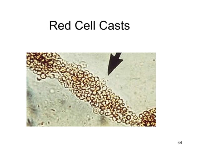 urinary analysis and test. $$&ppt bbbbbn | PPT