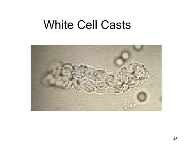 urinary analysis and test. $$&ppt bbbbbn | PPT