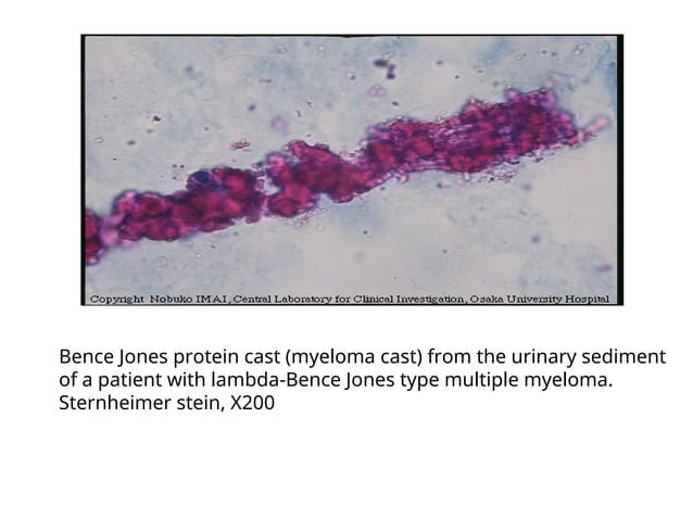 urinary analysis and test. $$&ppt bbbbbn | PPT