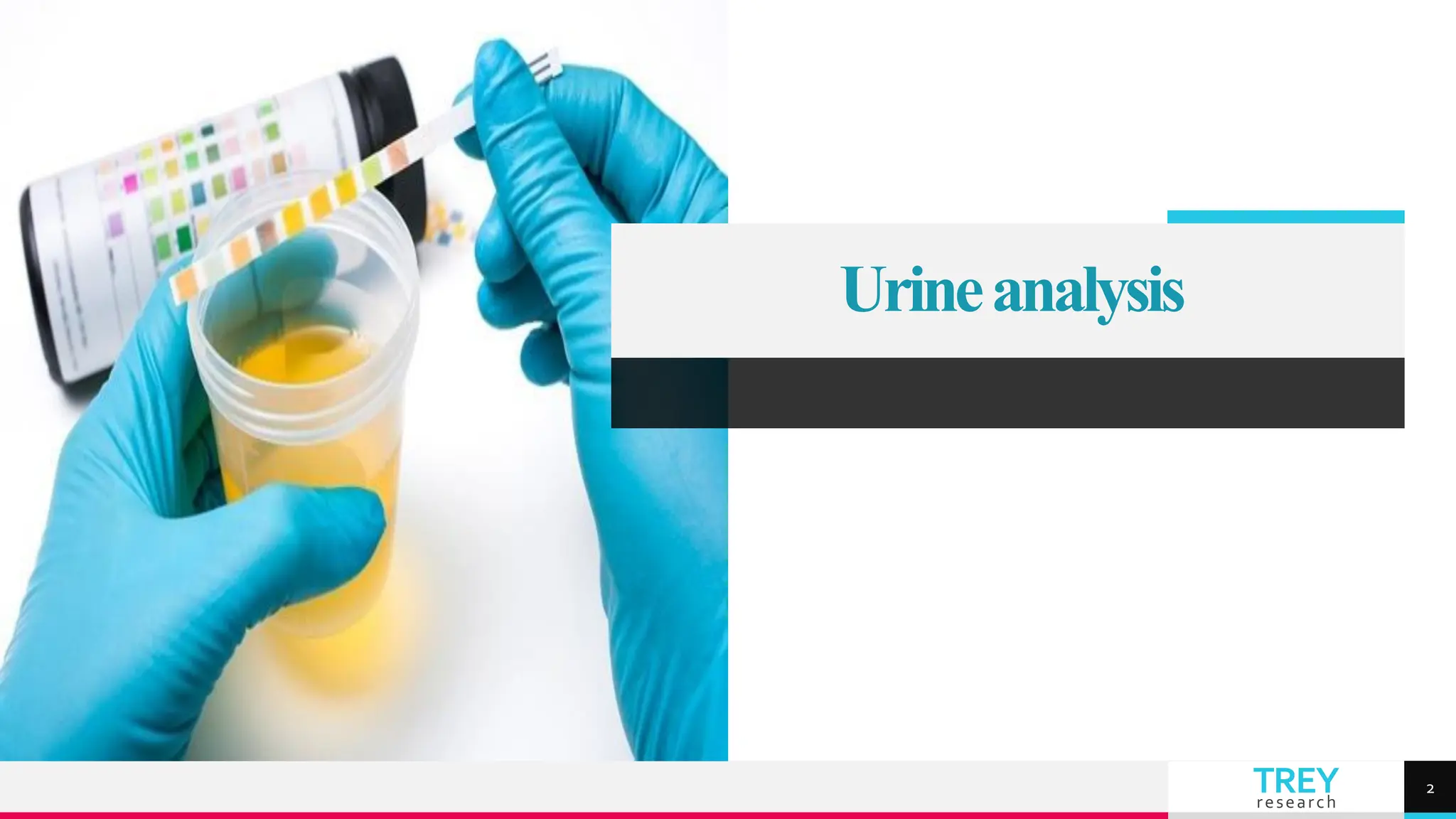 Urine analysis (physical, chemical and microscopic examination of urine ...