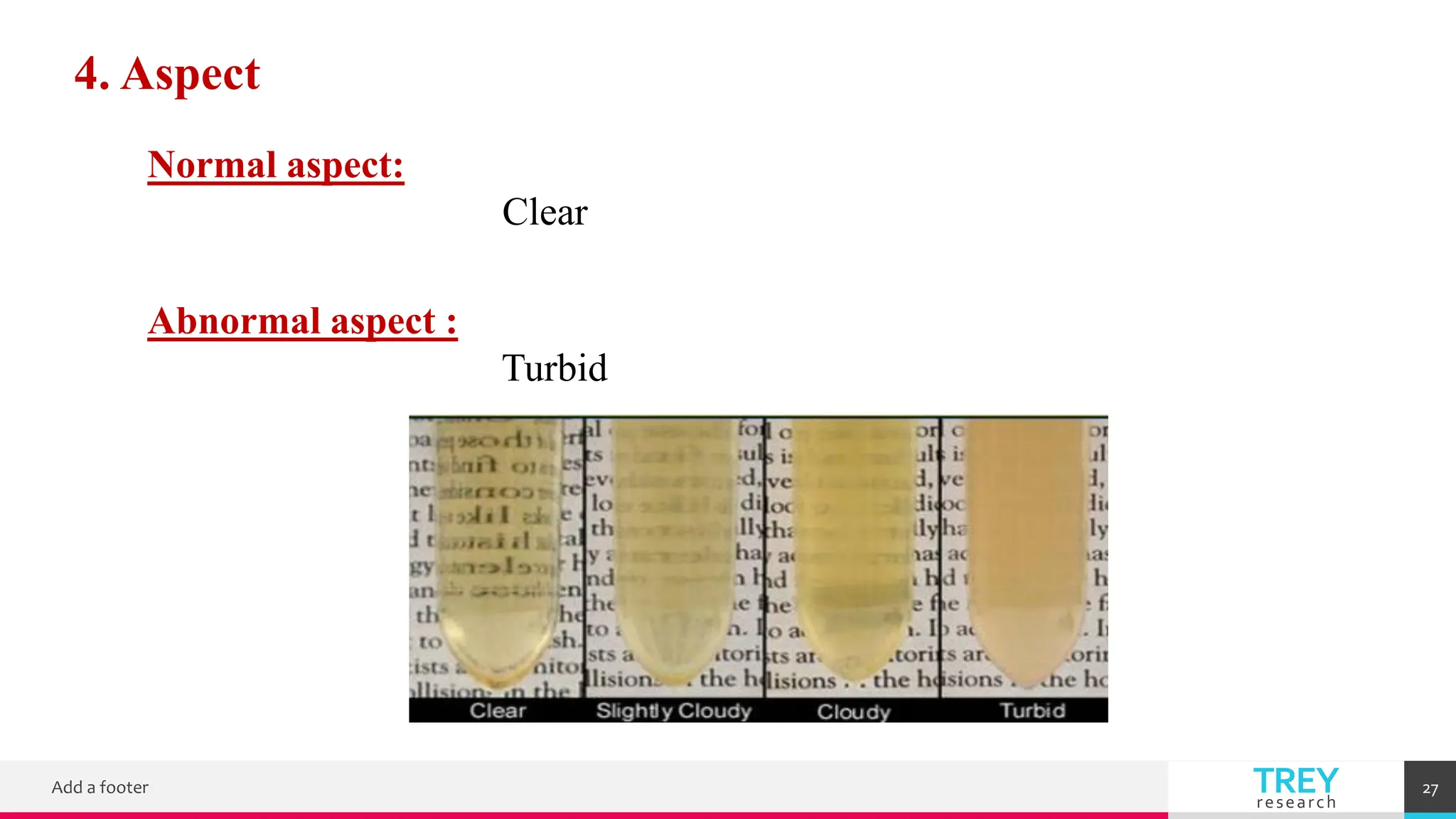 Urine analysis (physical, chemical and microscopic examination of urine ...