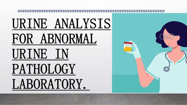 urine analysis.pptx