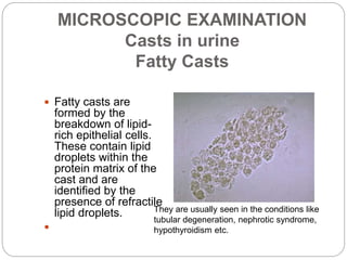 Fat Droplets In Urine