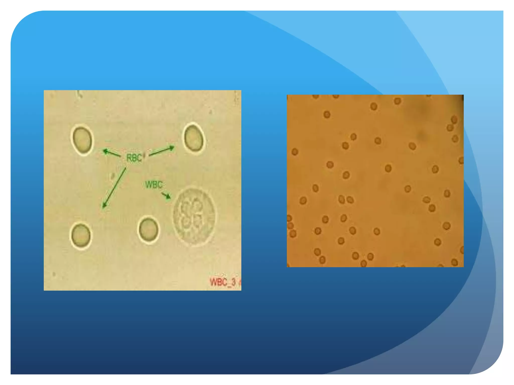 Urine analysis microscopic examination | PPTX