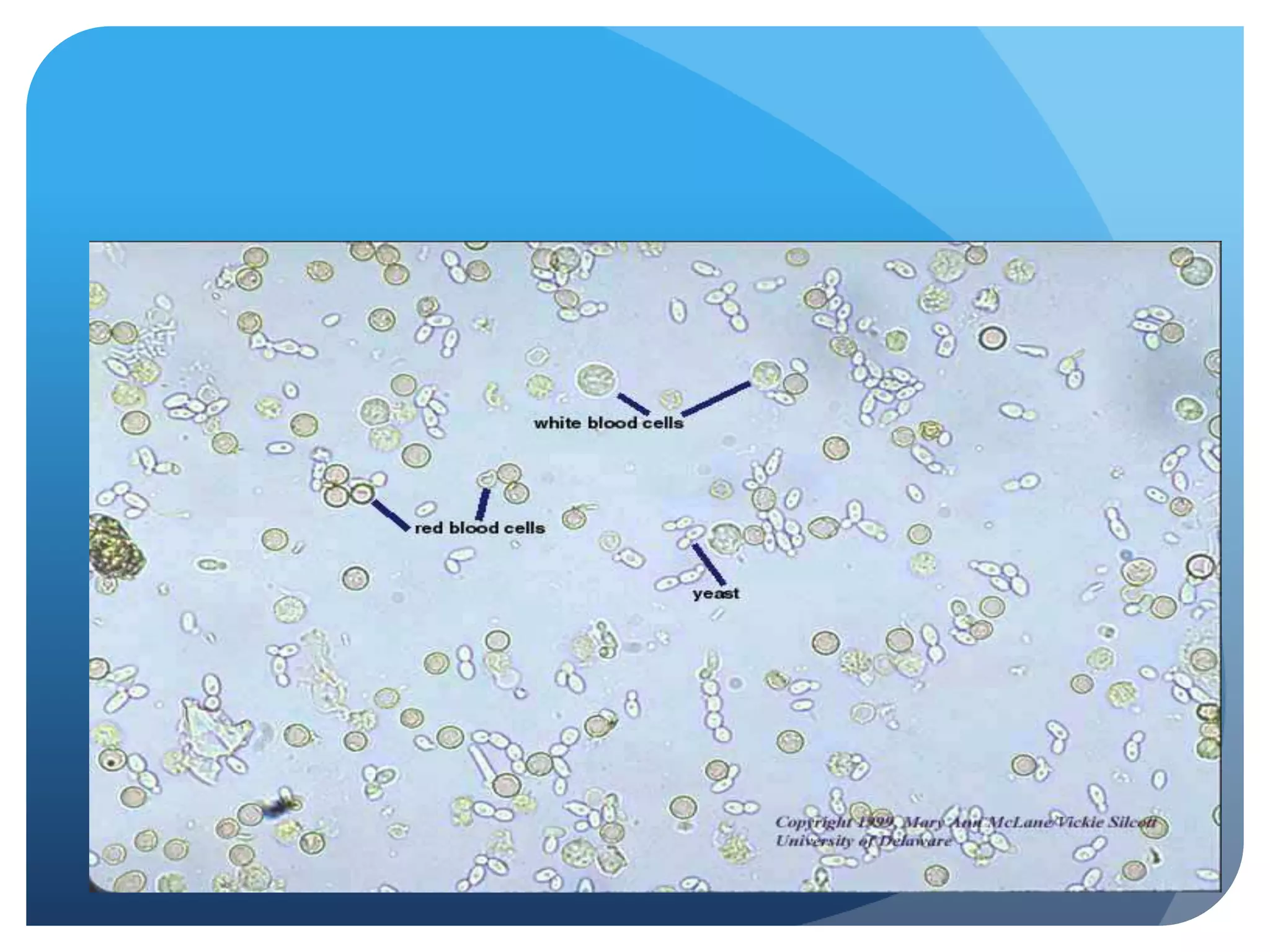 Urine analysis microscopic examination | PPTX
