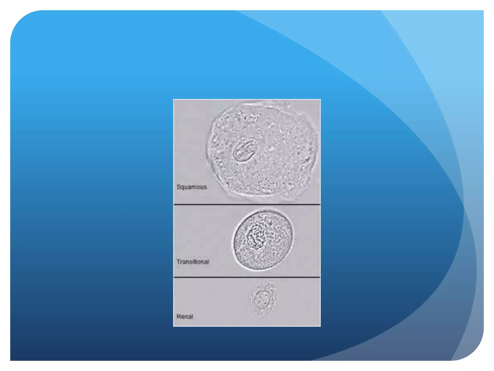 Urine analysis microscopic examination | PPTX