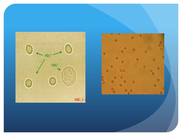 Urine analysis microscopic examination | PPTX