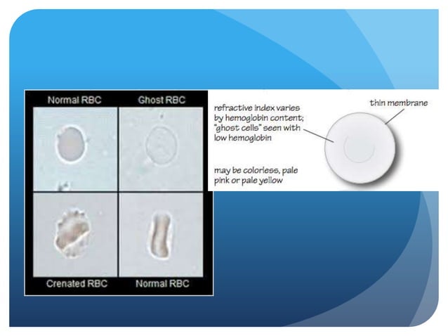 Urine analysis microscopic examination | PPTX