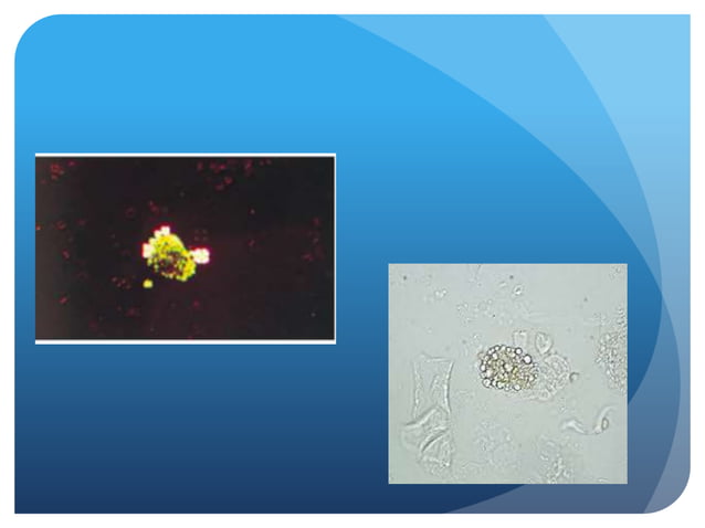 Urine analysis microscopic examination | PPTX