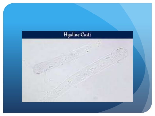 Urine analysis microscopic examination | PPTX