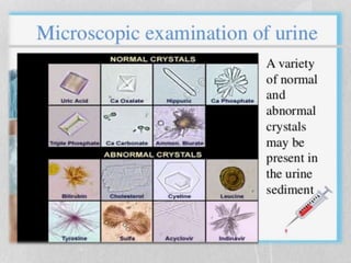 Urine analysis.ppt | PPTX