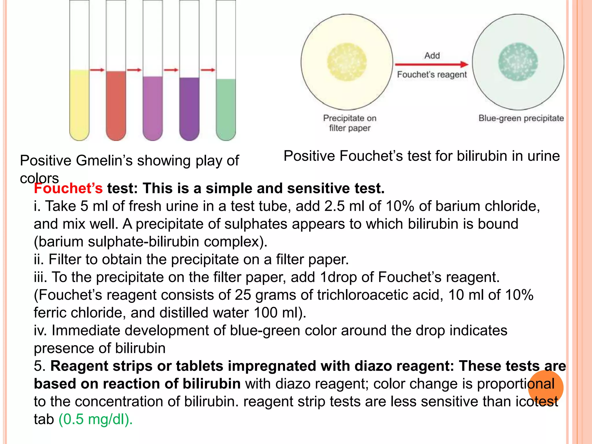 Urine analysis | PPTX