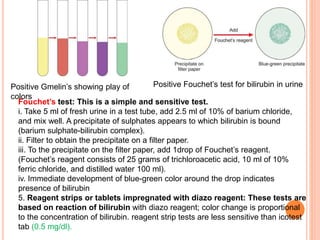 Urine analysis | PPTX