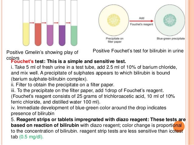 Urine analysis