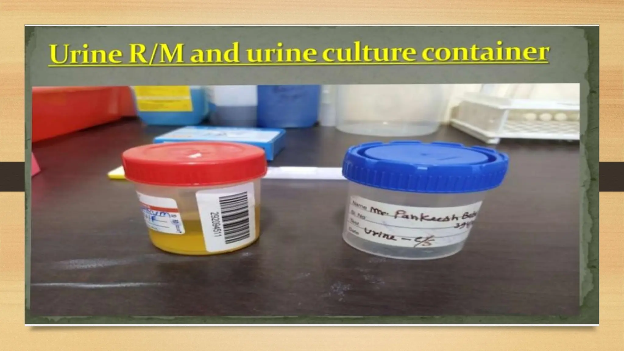 urine analysis pathology ppt. by Arshita Gupta | PPTX